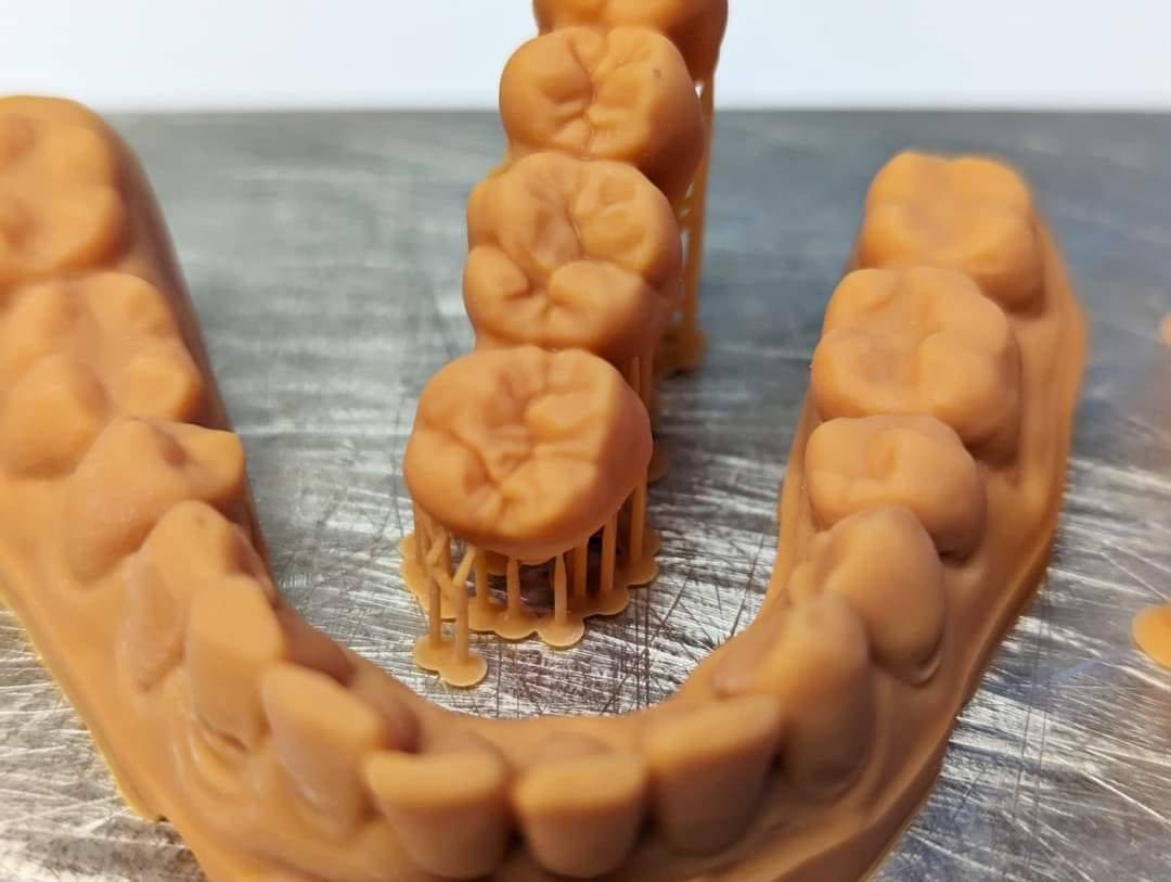 BlueCast FAST DENTAL MODEL